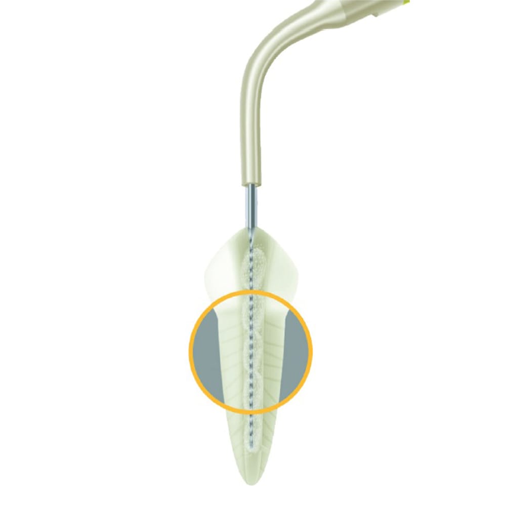 Acteon Irrisafe Canal Irrigation Files - Pack 4