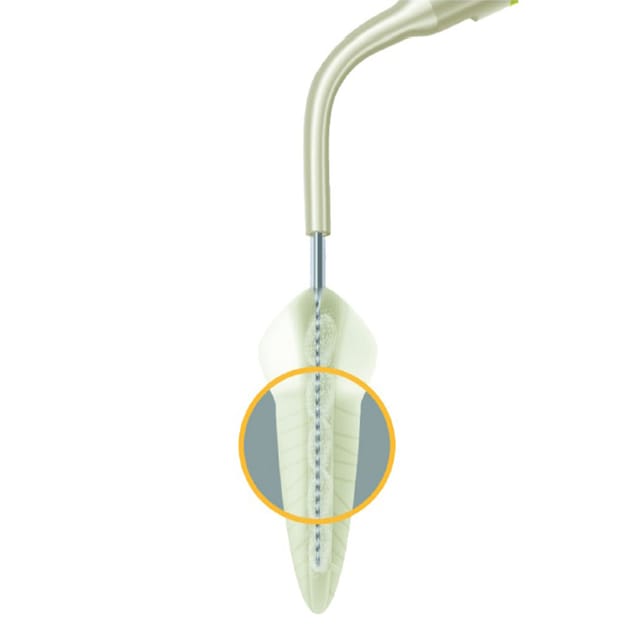 Acteon Irrisafe Canal Irrigation Files - Pack 4